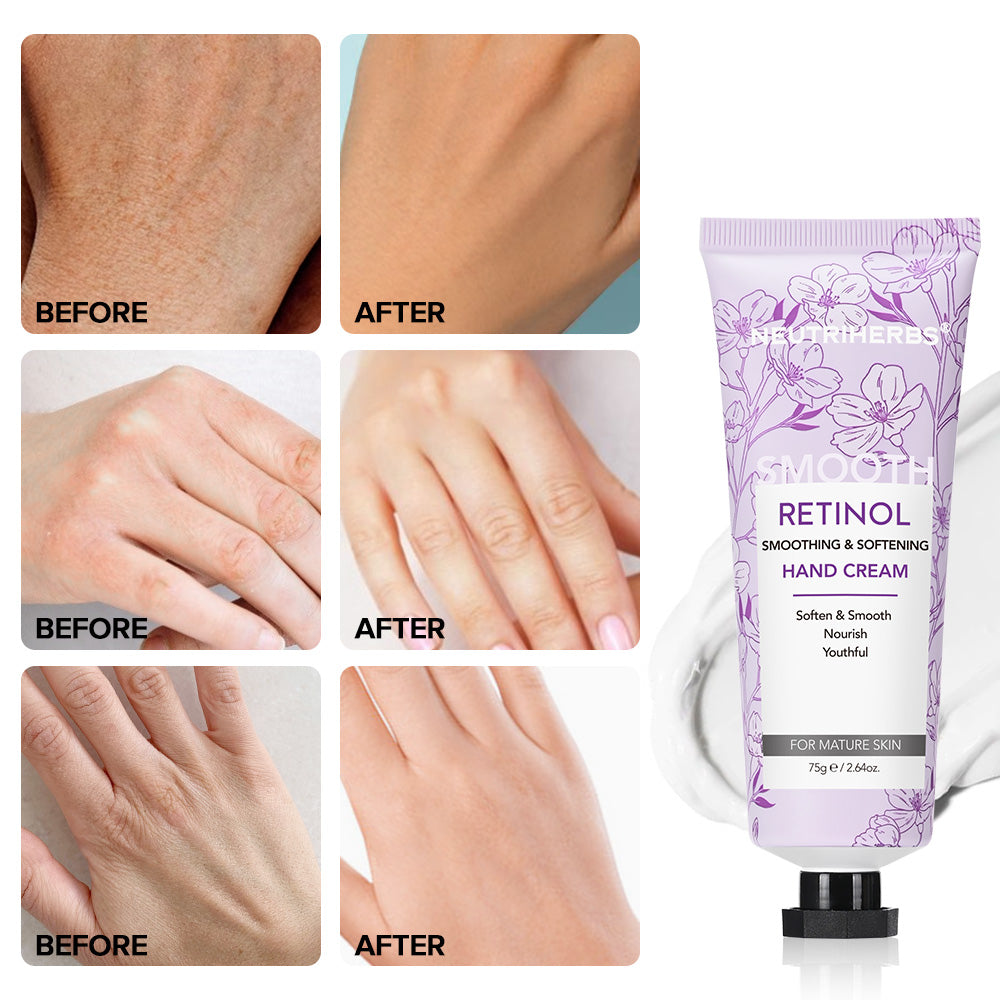 Retinol Smooth and Soften Hand Cream - 75g – Neutriherbs