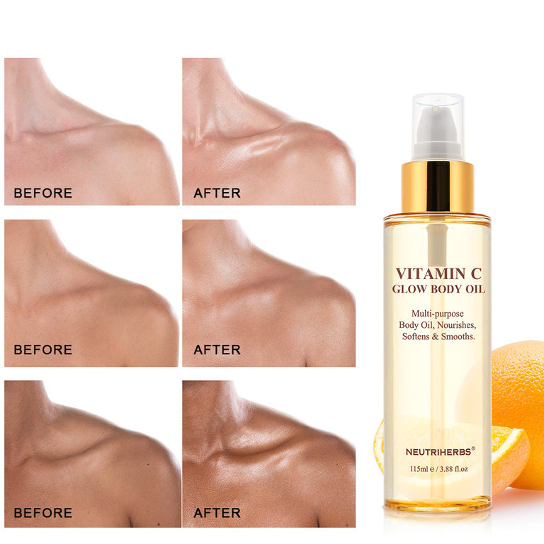 Vitamin C Glow Body Oil - 115ml – Neutriherbs